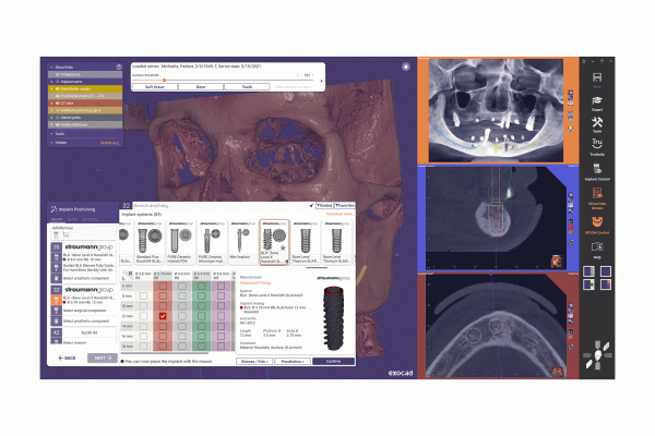 exoplan Core Version 3.1