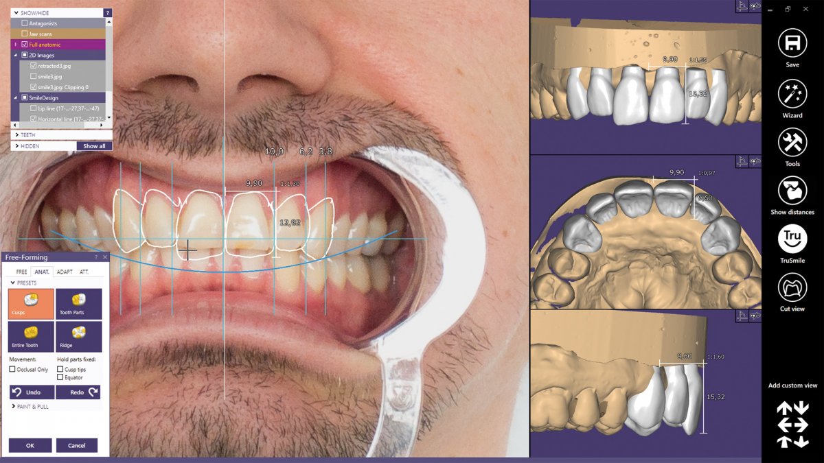 exocad Ultimate Lab Bundle Kauf